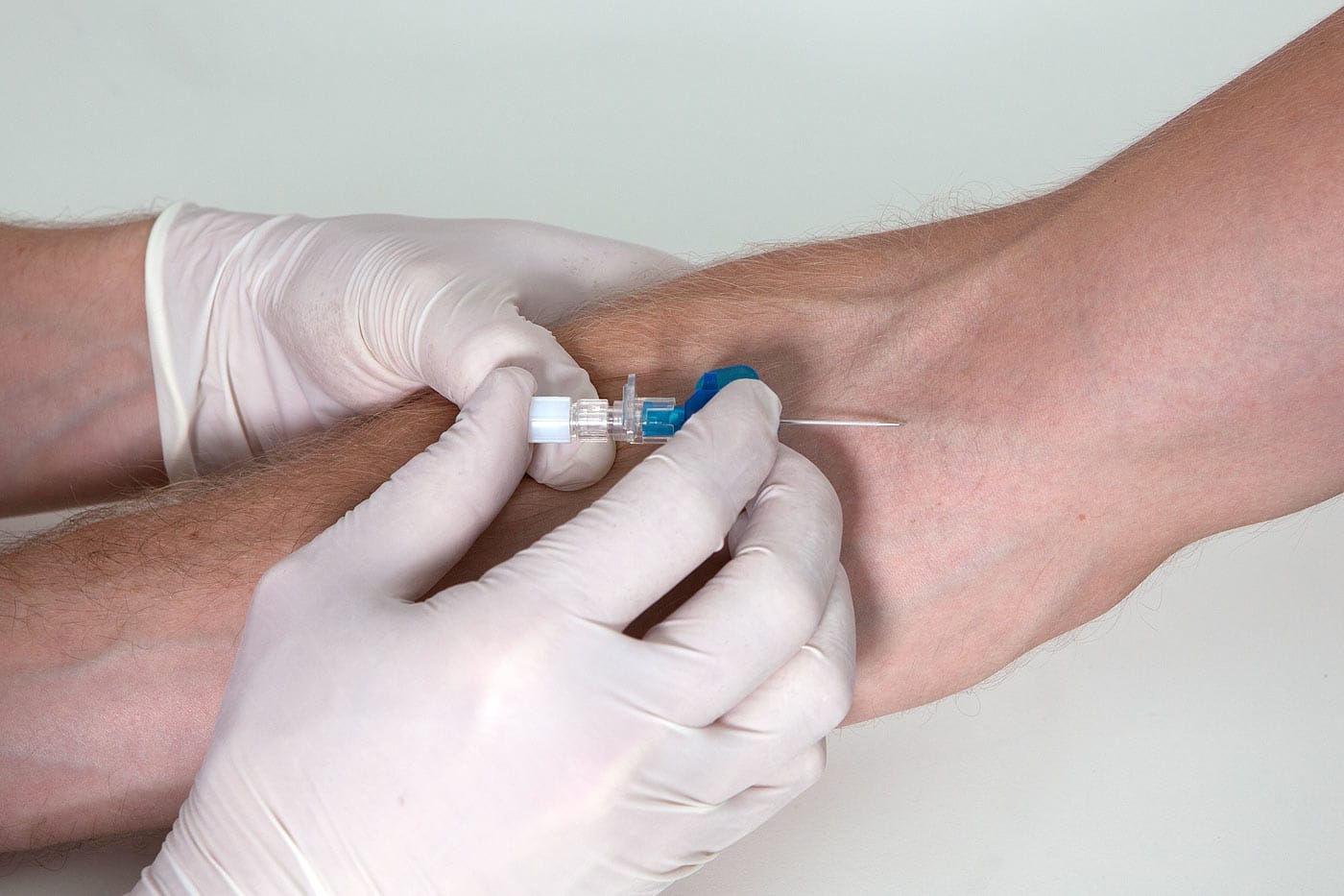 Avoiding Complications in IV Cannulation and Phlebotomy: The Critical ...